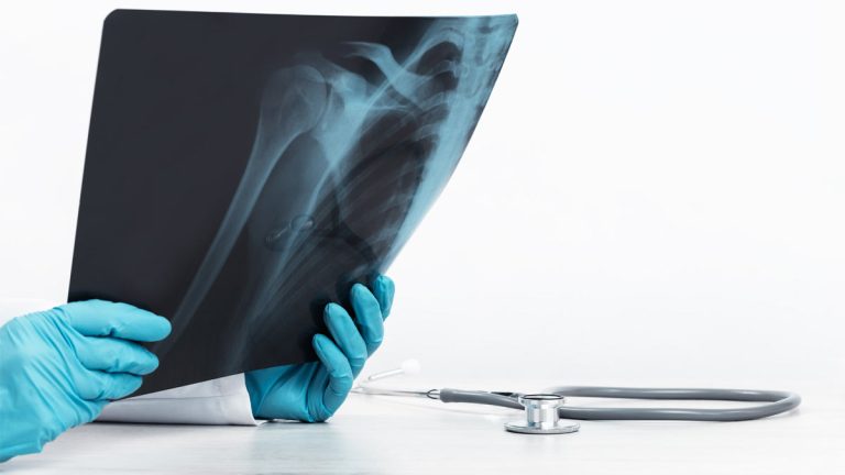 Risks of Medical Imaging - HealthLinks SC